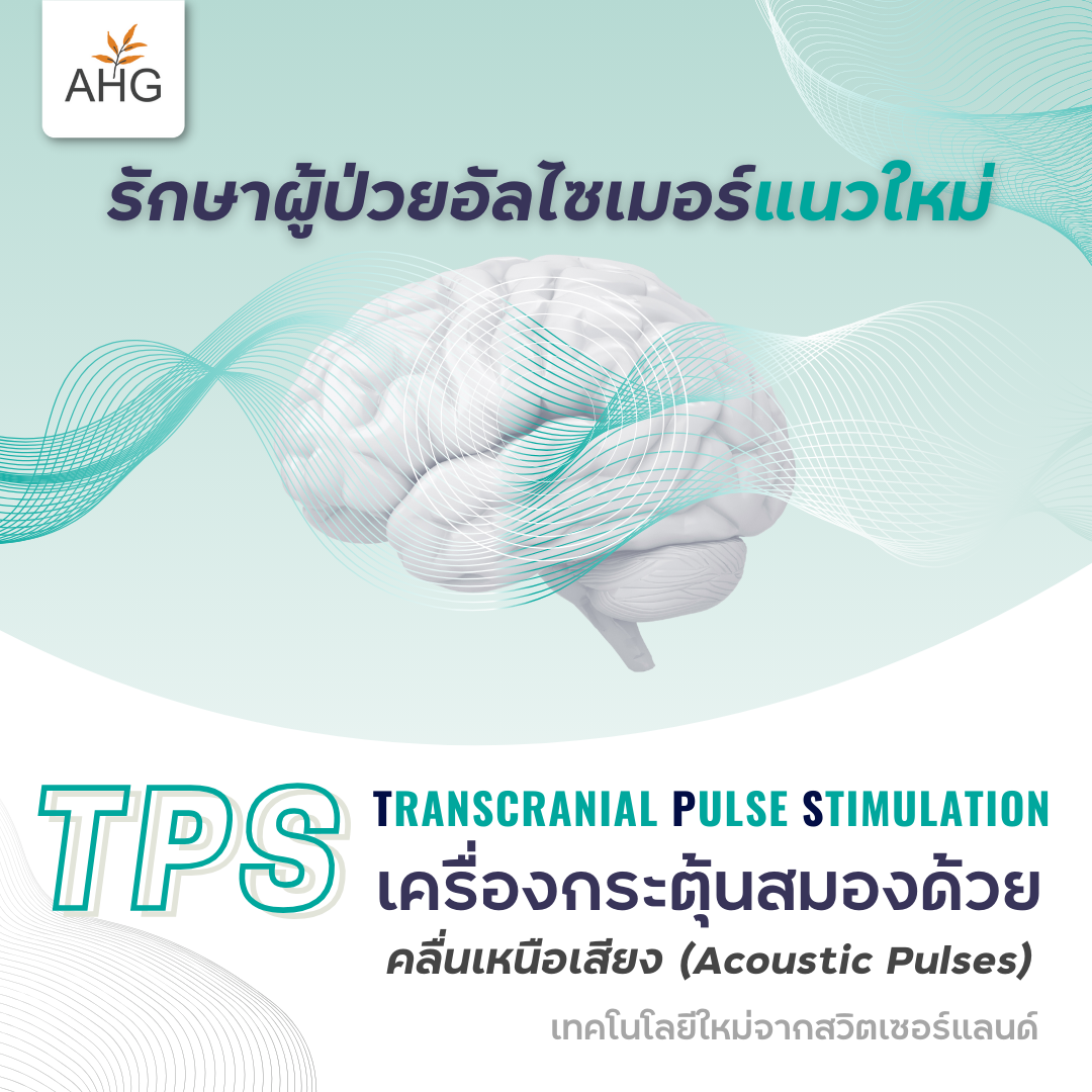 รักษาผู้ป่วยอัลไซเมอร์แนวใหม่ด้วย Transcranial Pulse Stimulation (TPS)
